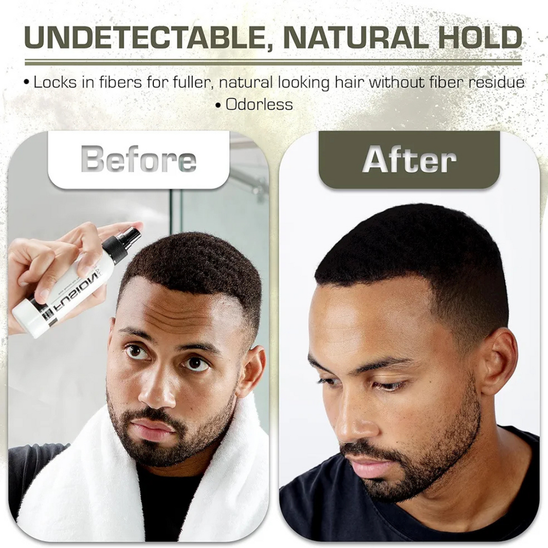 Instantly Conceal Bald Spots And Fill In Patchy Beards – Real Hair Fusion